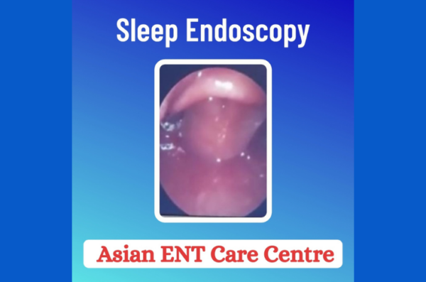 Sleep Endoscopy - ASIAN ENT CARE